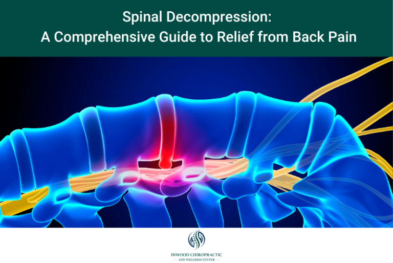 Spinal Decompression: A Comprehensive Guide to Relief from Back Pain ...